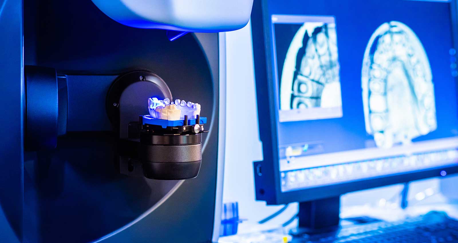 Nanodent | Laboratorio Prótesis Dental | Tecnología CAD/CAM